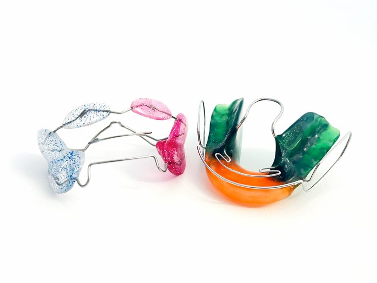 Herausnehmbare Zahnspange - KFO Eckernförde