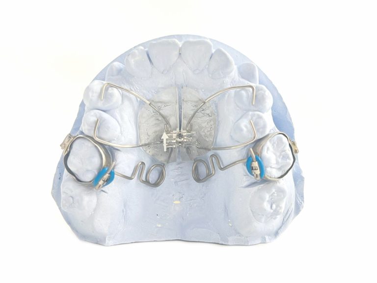 Zusatzapparaturen - Fachpraxis für Kieferorthopädie Eckernförde