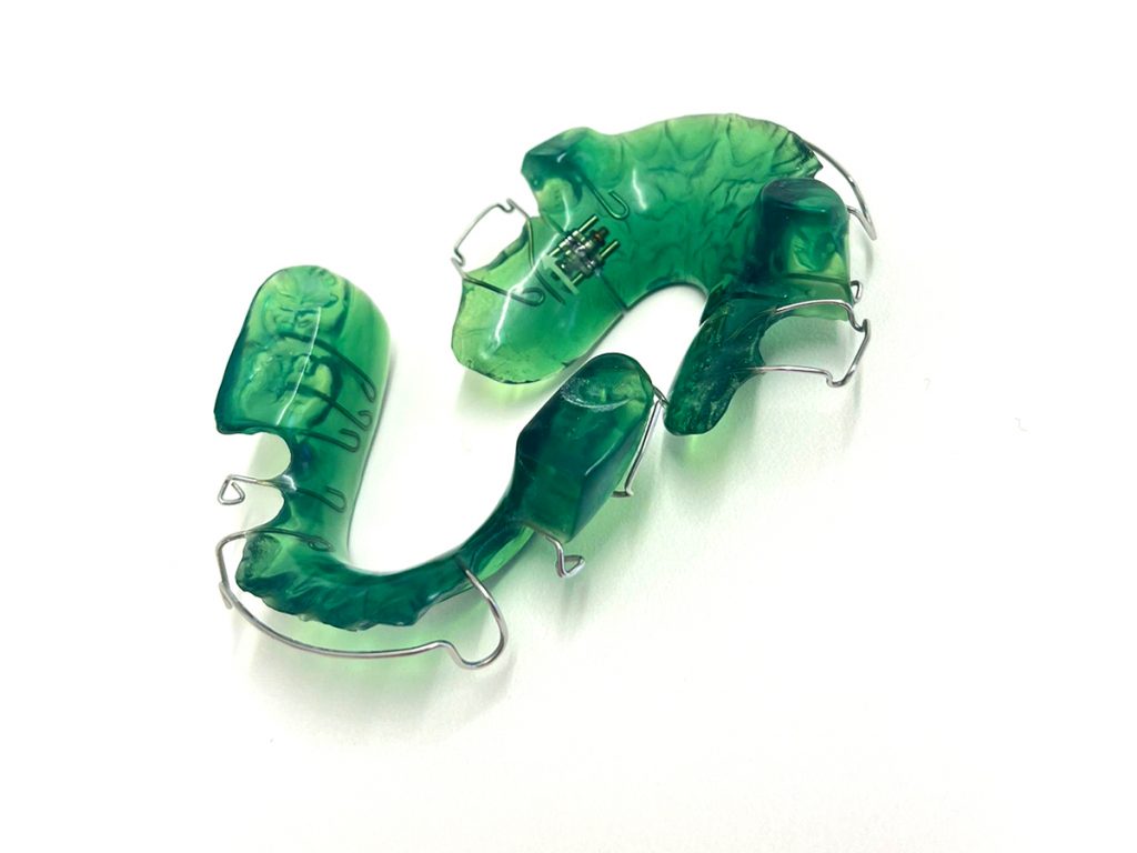 Spangenvergleich - Fachpraxis für Kieferorthopädie Eckernförde