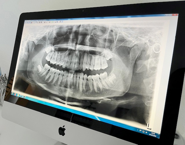 Diagnostik - Fachpraxis für Kieferorthopädie Eckernförde